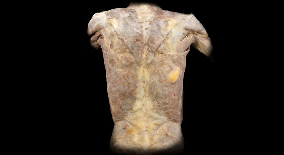 Muscles of the back - 3D-Modell - Mozaik Digitale Bildung und Lernen