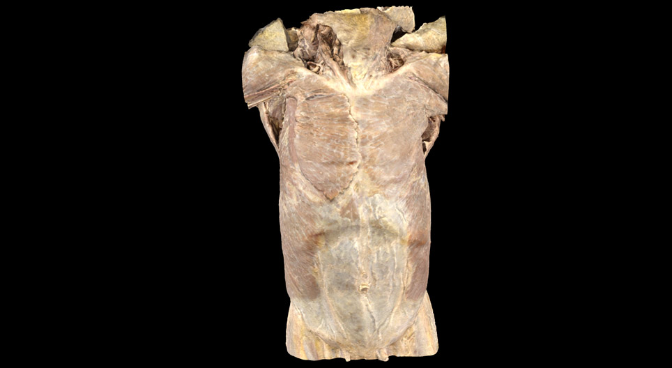 Muscles of the anterior chest wall - 3D-Modell - Mozaik Digitale ...