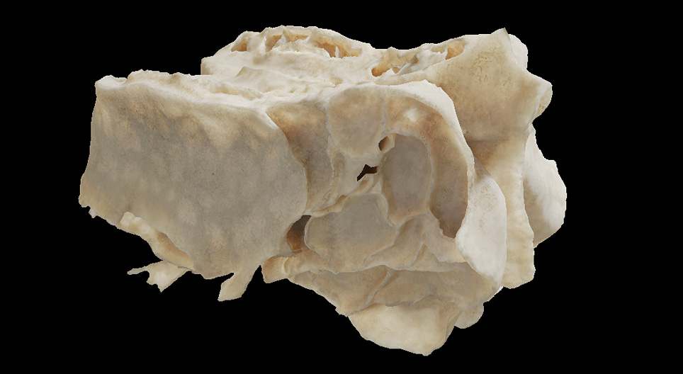 Ethmoid bone - 3D scene - Mozaik Digital Education and Learning