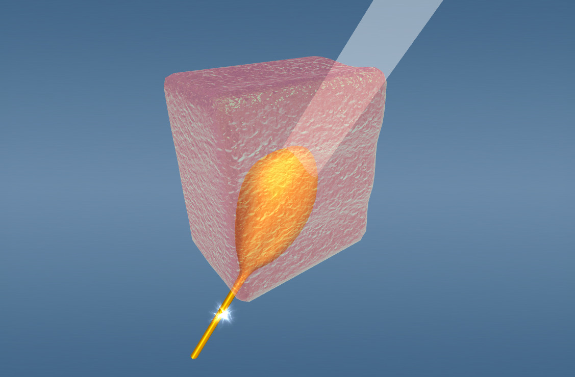 Diversity of light-detecting organs - 3D scene - Mozaik Digital ...