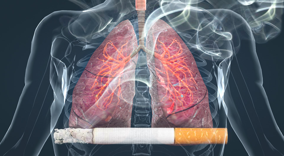 Effects of smoking on the lungs - 3D scene - Mozaik Digital Education ...