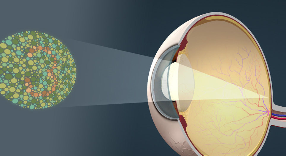 Colour vision deficiency - 3D scene - Mozaik Digital Education and Learning