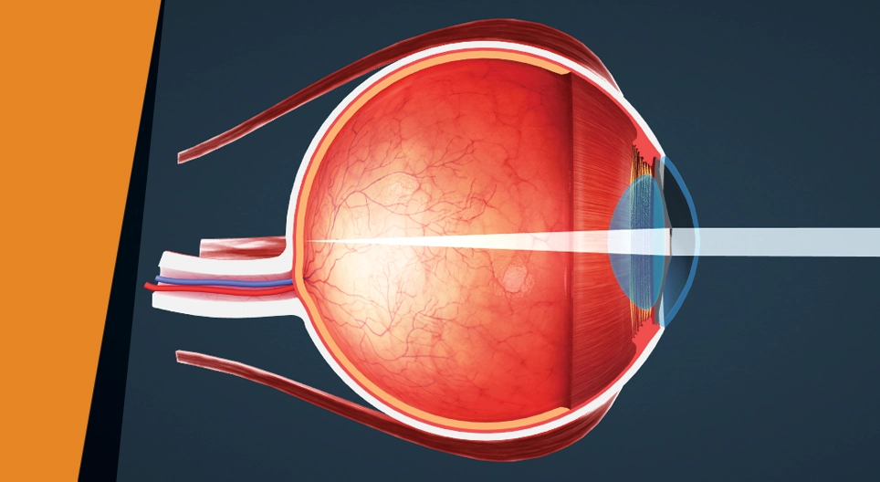 Blind spot - Digital lessons - Mozaik Digital Education and Learning