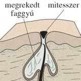 Mitesszer - صورة - موزايك للتعليم و التعلم الرقمي