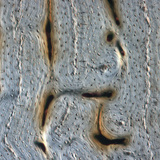 Bone (longitudinal section) - image - Mozaik Digital Education and Learning