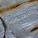 Bone (longitudinal section) - image - Mozaik Digital Education and Learning