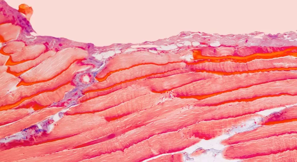 What tissues make up our muscles? - Digital lessons - Mozaik Digital ...