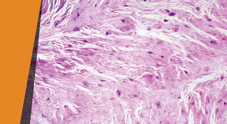 Directed strike - Digital lessons - Mozaik Digital Education and Learning