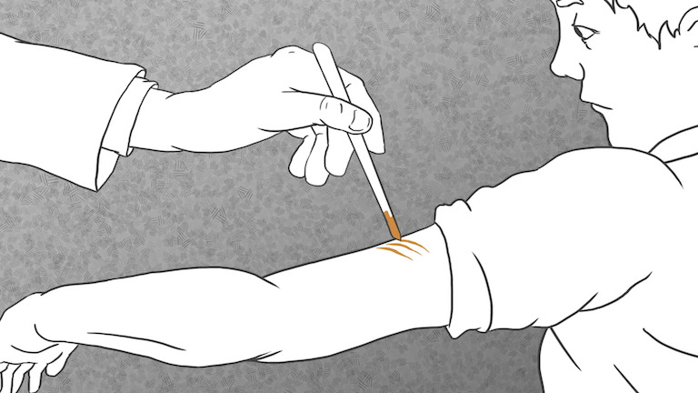 A história das vacinas - vídeo - Ensino e aprendizagem digitais Mozaik