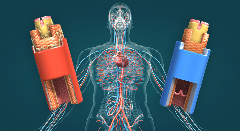 Krvné cievy - 3D-model - Mozaik digitálne vyučovanie a štúdium