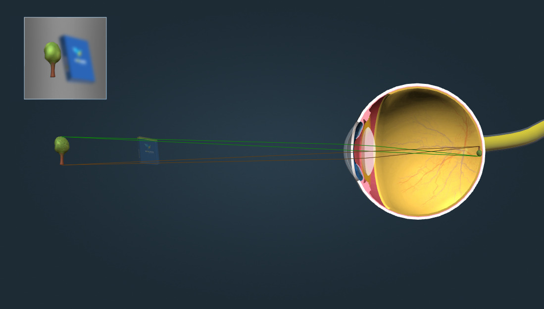 The mechanism of vision - 3D model - Mozaik digitalno obrazovanje i učenje