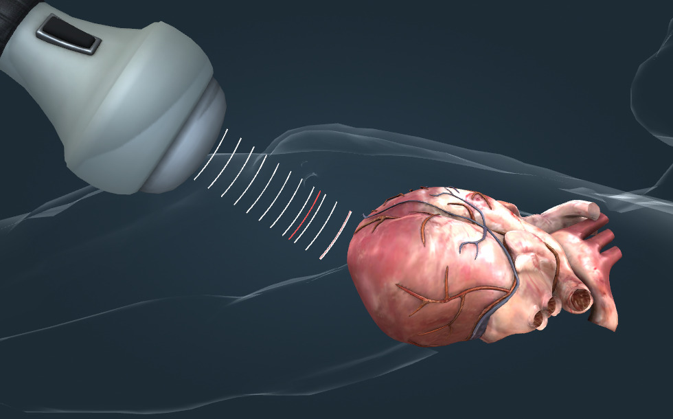 Hiệu ứng Doppler - Cảnh 3D - Giáo dục và học tập kỹ thuật số Mozaik